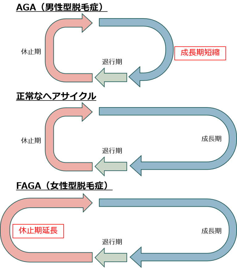 女性の抜け毛や薄毛「FAGA」とは？AGAとの違いも解説！｜AGAを巻き戻せ！